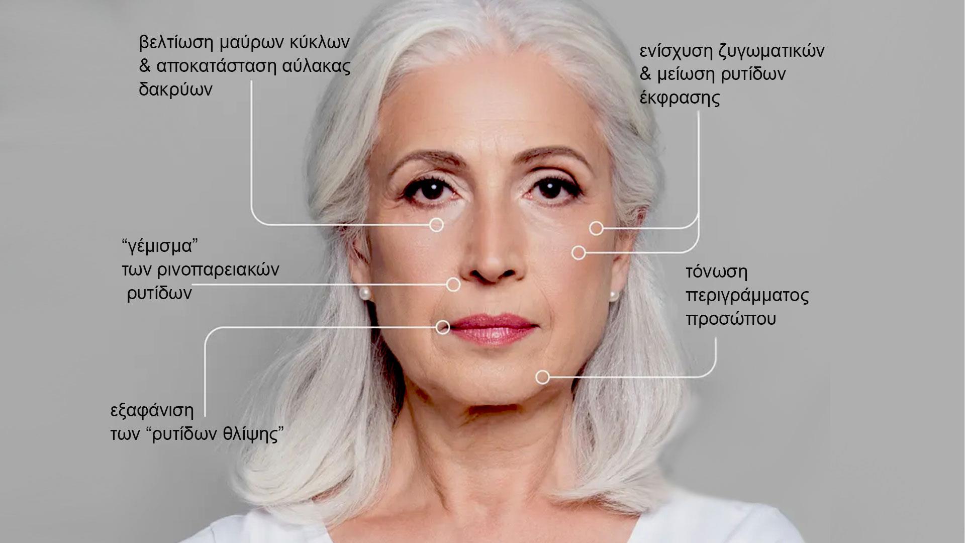 Υγρό λίφτινγκ (Liquid facelift) Χωρίς Νυστέρι | THE ANTIAGERS