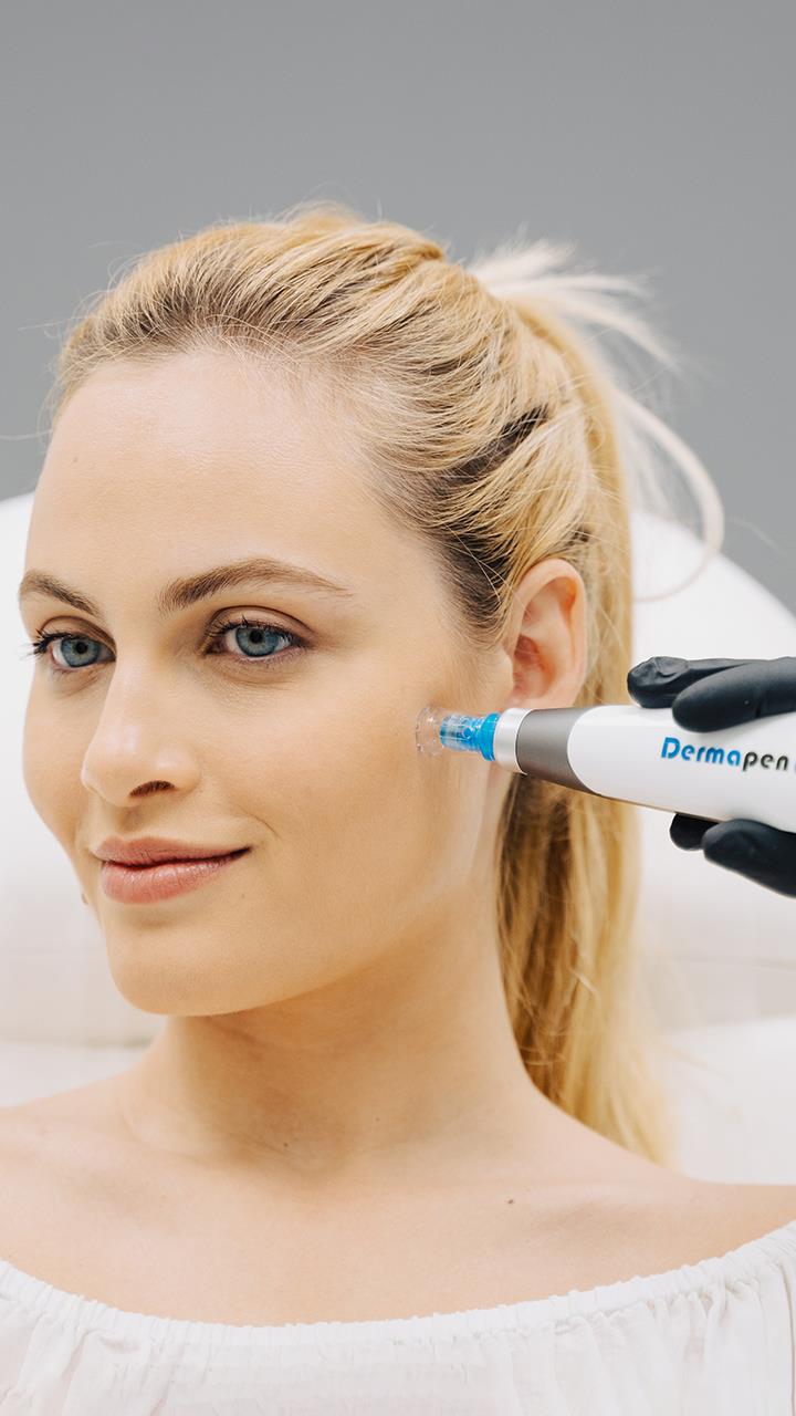Dermapen Προσώπου για Ρυτίδες, Ουλές, Δυσχρωμίες | THE ANTIAGERS