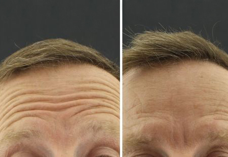 Φωτογραφίες Πριν & Μετά