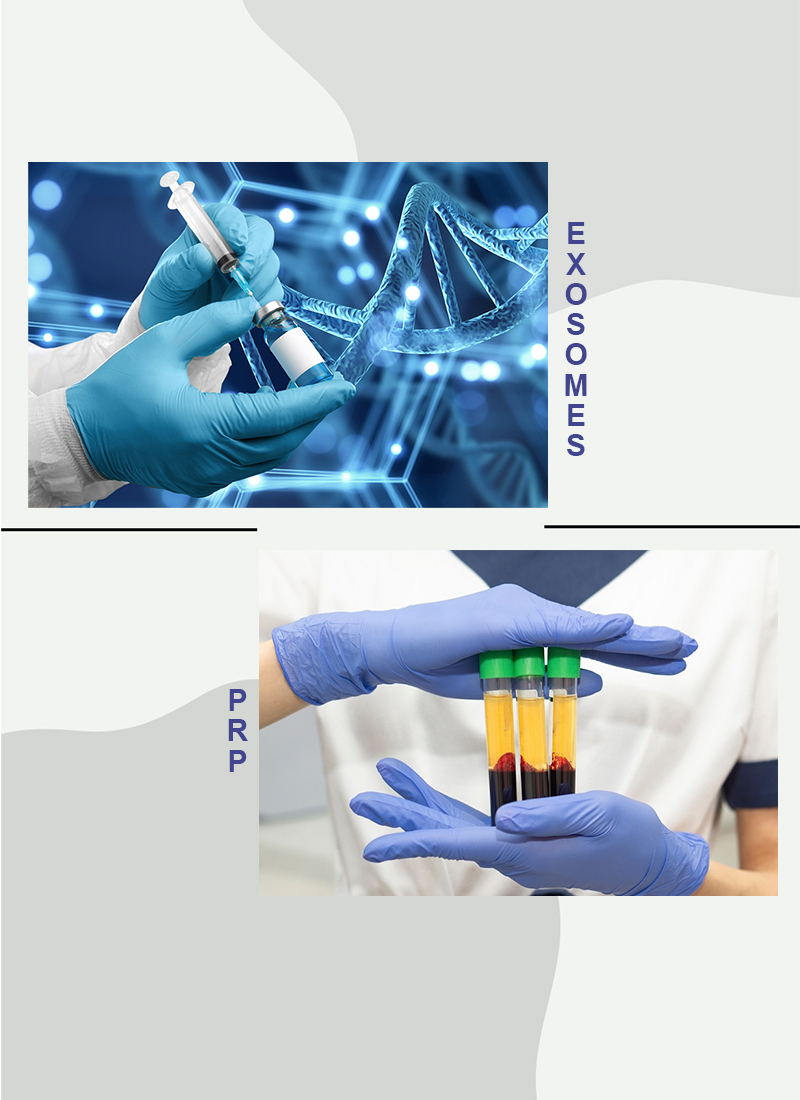 Θεραπεία με Εξωσώματα (Exosomes) | Τι είναι | Πως γίνεται | Αποτέλεσμα