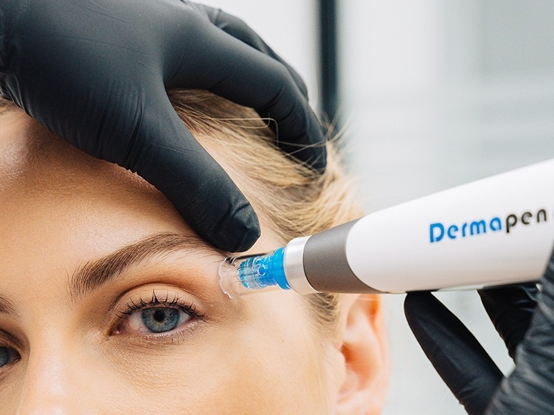 Dermapen Προσώπου για Ρυτίδες, Ουλές, Δυσχρωμίες | THE ANTIAGERS